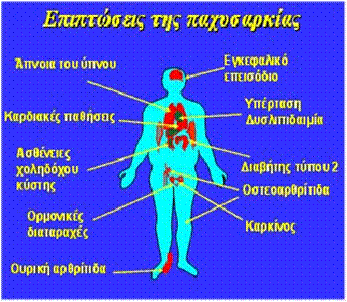 Συνέπειες από την Κακή Διατροφή :: Μεσογειακή Διατροφή από το Στ1